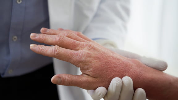 Understanding Chronic Hand Eczema | Dermaworld