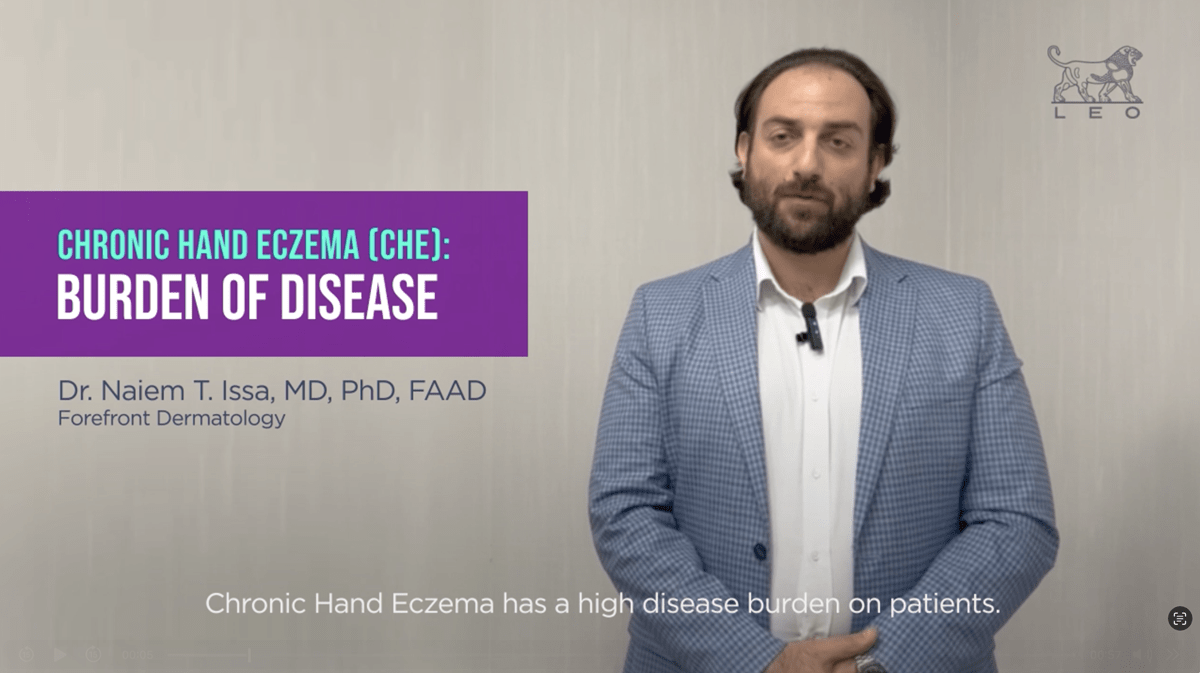 HCP Survey on Chronic Hand Eczema Burden